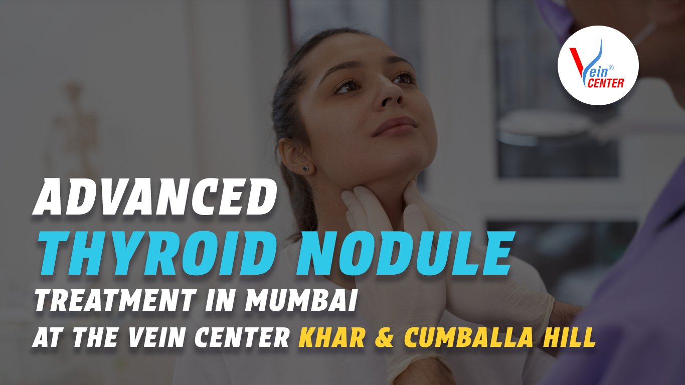Advanced Thyroid Nodule Treatment | The Vein Center